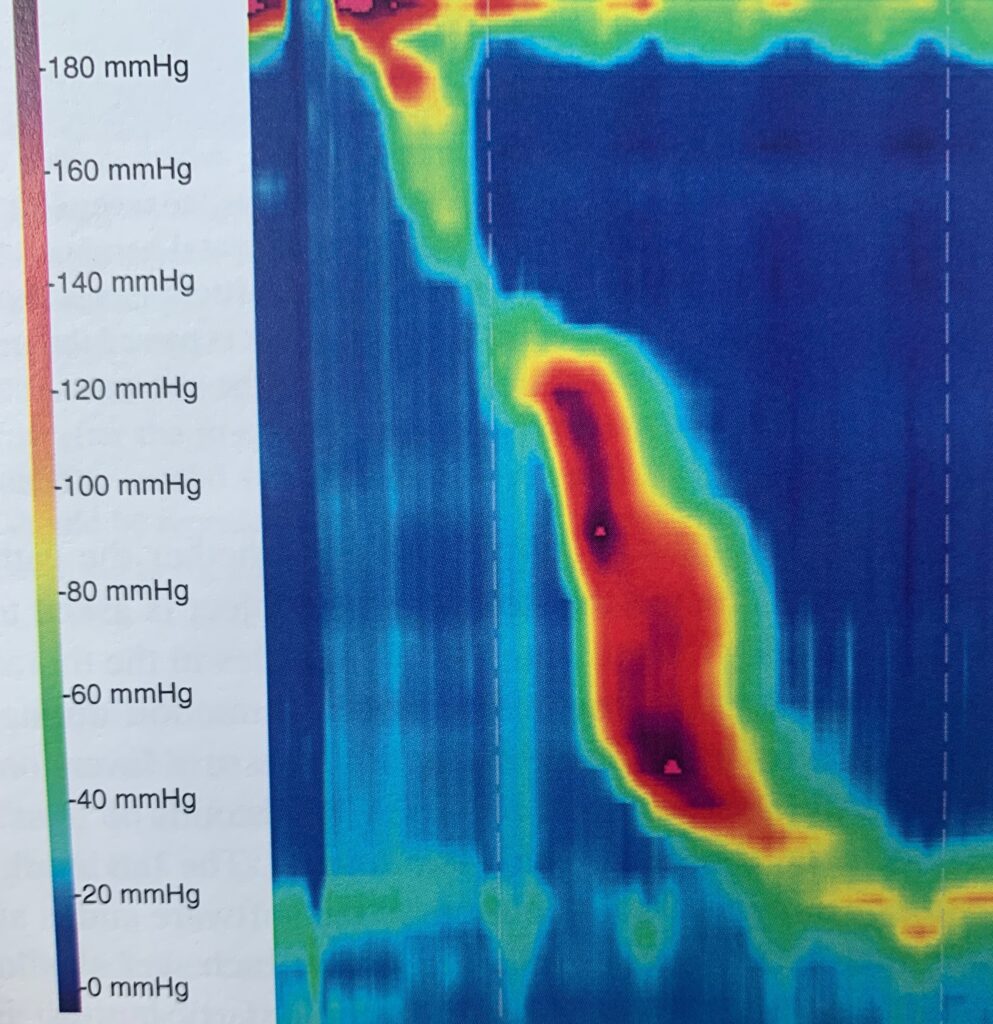 PROCEDURES – Digestive Disease Medicine of Central New York